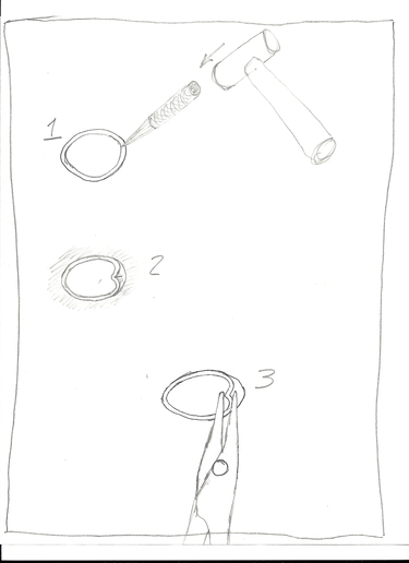 Brake cross shaft bushing and plugs | Yesterday's Tractors Forums